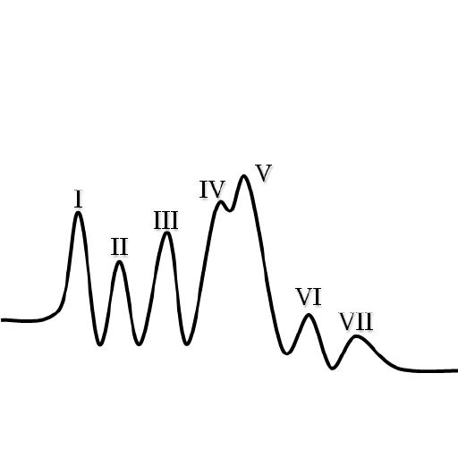Understanding Intraoperative Neuromonitoring (IONM) – The Nerve Desk